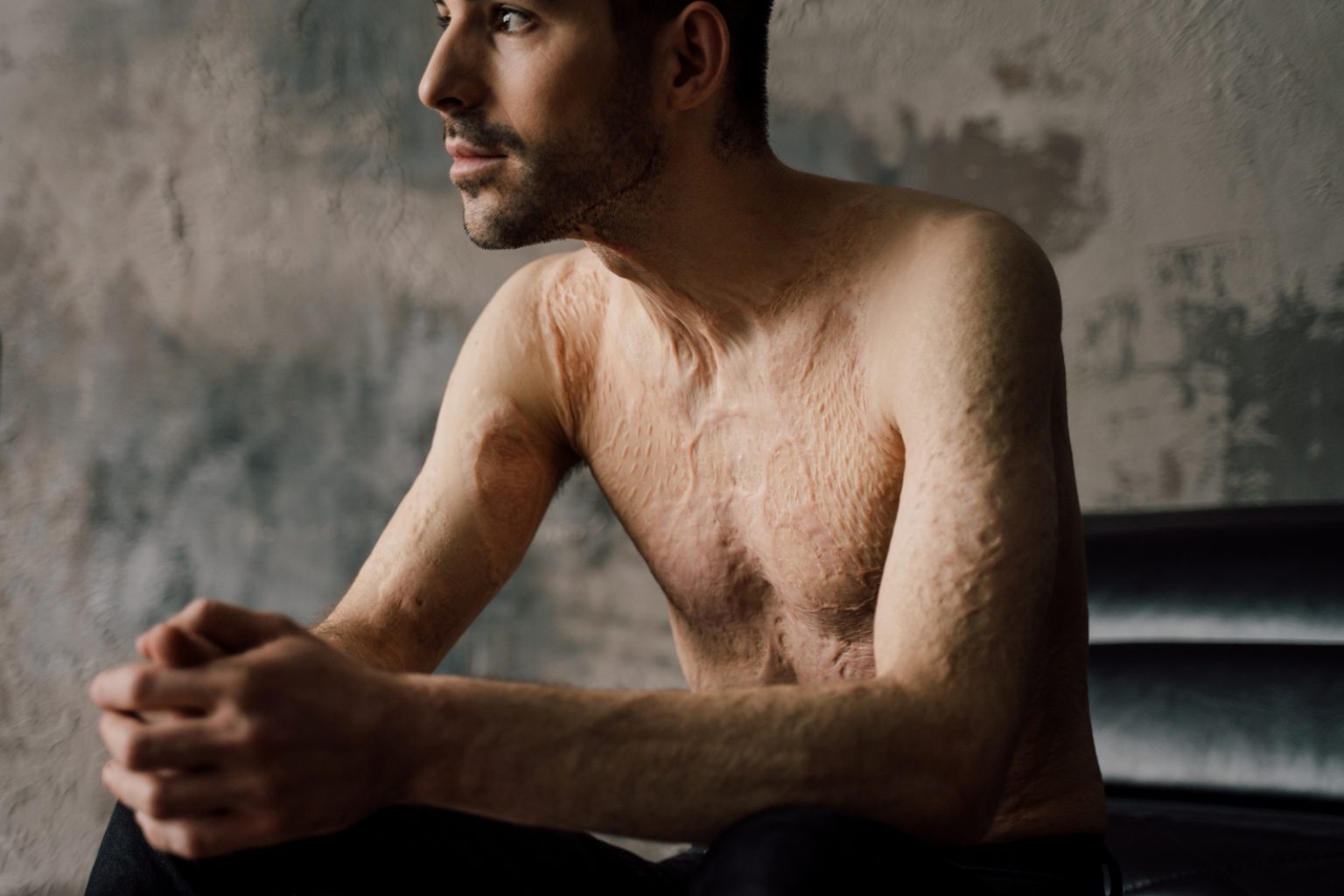 Model mit Handicap: So sicherst du dir Aufträge